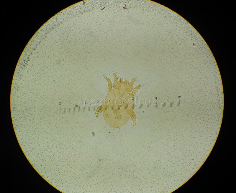 Macro Animal Parasite Find with Microscope. Stock Photo - Image of ...