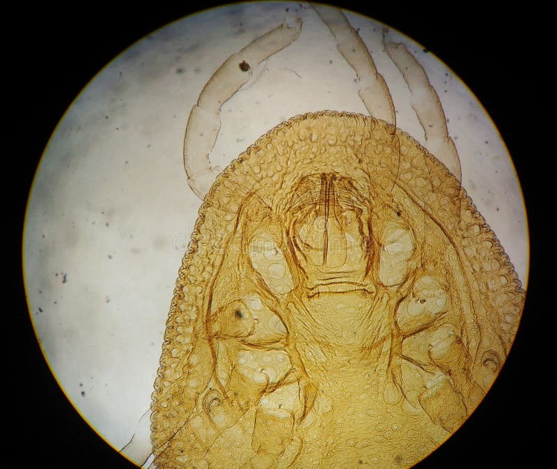 Macro Animal Parasite Find with Microscope. Stock Photo - Image of skin ...