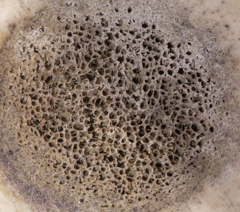 Bone Spongy Structure Close-up, Healthy Texture of Bone Stock Photo ...