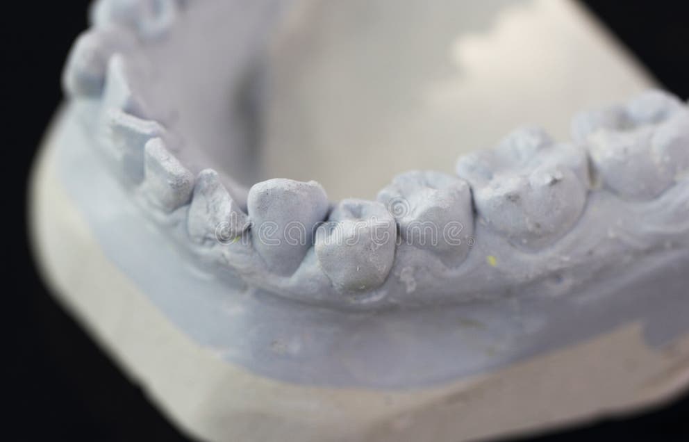 Macro Close Up View of Plaster Model of Crowns of Lower Front Teeth ...