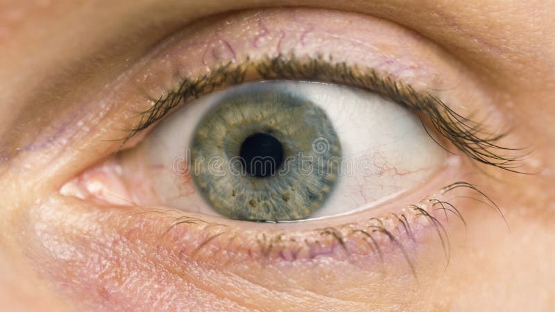 Macro D'oeil De Rouge De Conjonctivite Image stock - Image du maladie ...