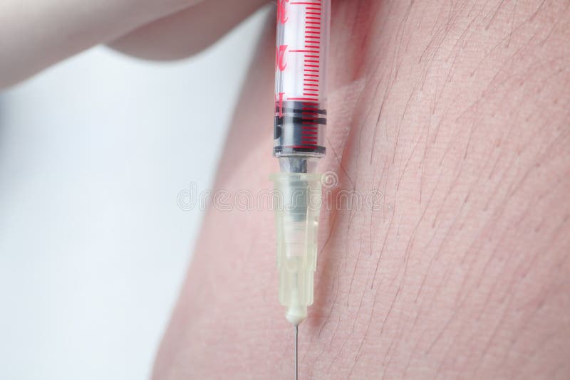 Injection D'une Drogue Dans Une Veine Photo stock - Image du bras ...