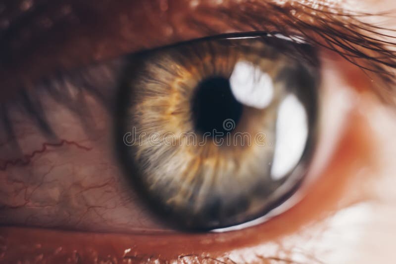 Macro Eyes with Bursting Red Blood Vessels. Eyeball Covered with Blood ...
