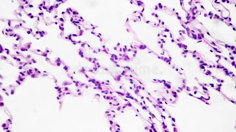 Macro Footage of Human Bronchiolus in Section Filmed Under Microscope ...