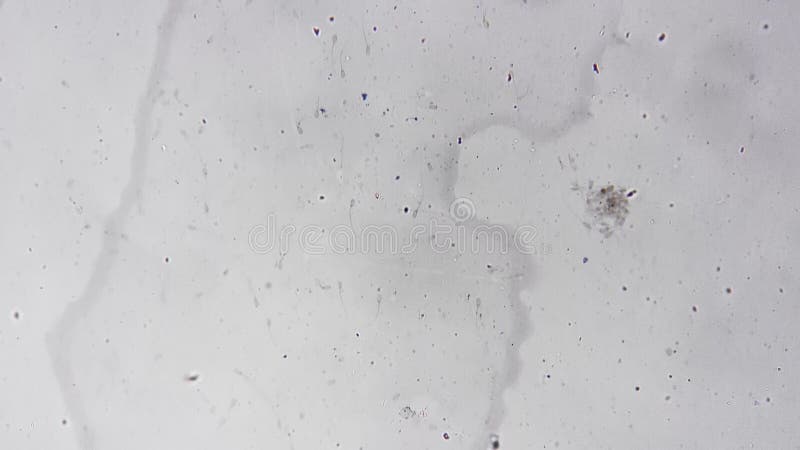 Macro Footage of Sperm Smear Sample Magnified Under Microscope 200x and ...