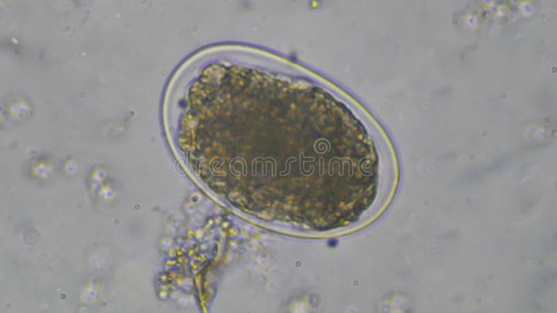 Macro Hookworm Eggs Parasite in Stool Examination Stock Photo - Image ...