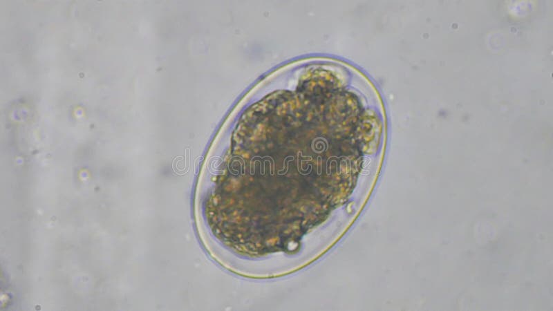 Eggs of Parasite in Stool Examination on White Background Stock Image ...