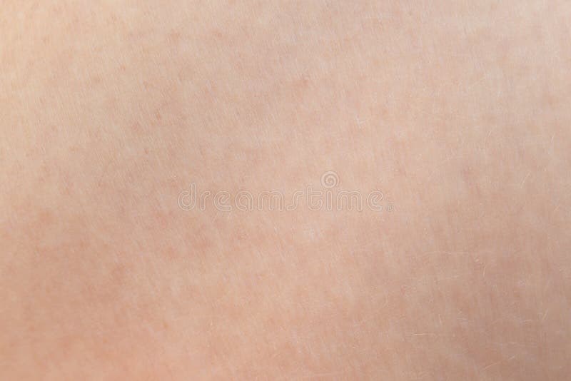 Macro of Human Skin. Human Skin Texture Stock Photo - Image of abstract ...