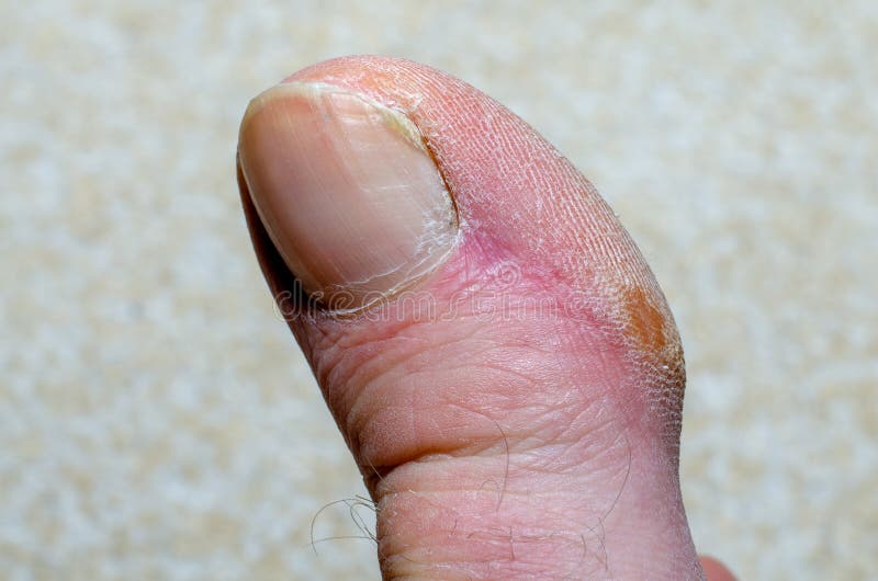 Macro of a Human Thumb with Skin Texture Stock Image - Image of macro ...