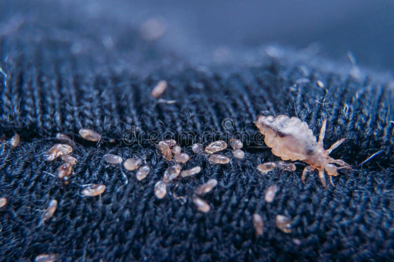 Macro of Male and Female Chewing Louse Stock Photo - Image of hair ...