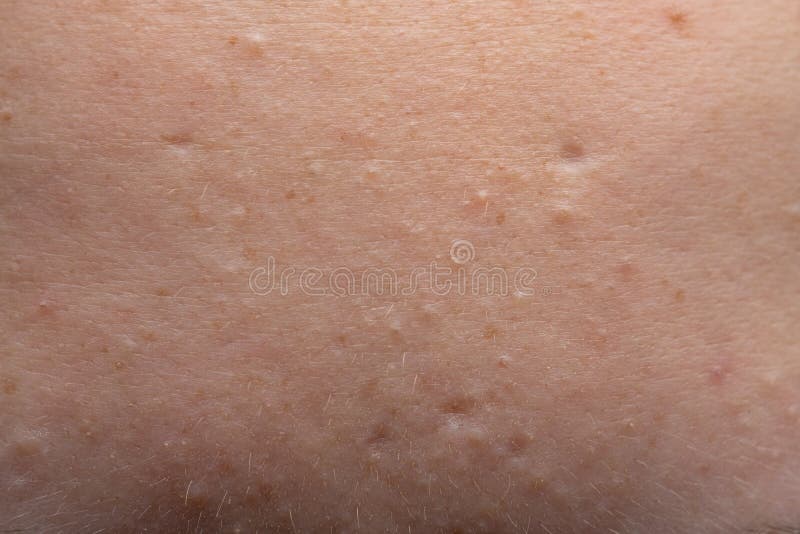 Macro Photo of the Human`s Forehead Texture Stock Image - Image of ...