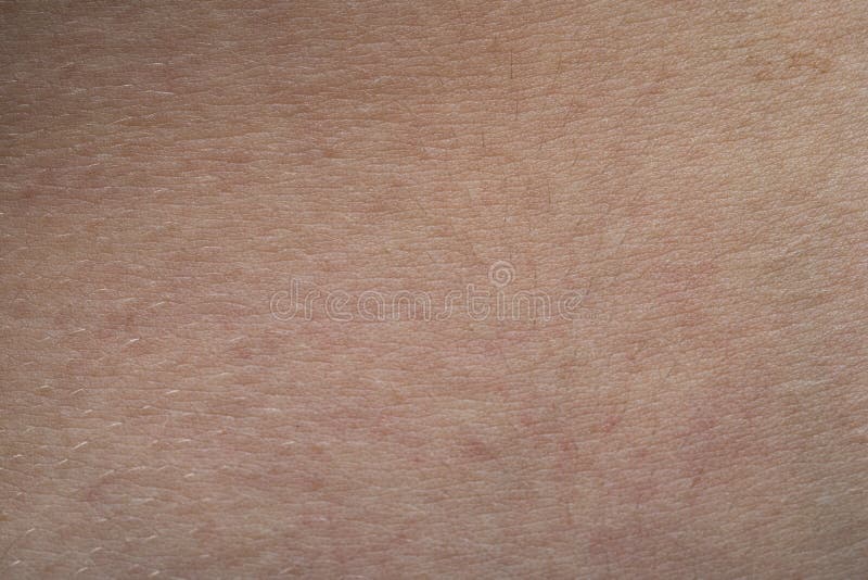 Texture of Man`s Skin with Scar Burn, Closeup Photo Stock Photo - Image ...