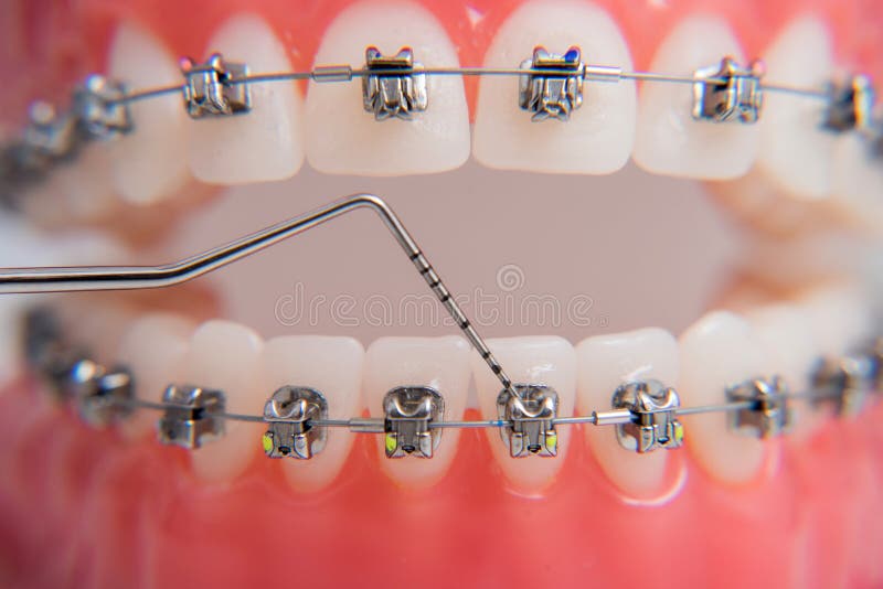 On Macro Photos Shows How the System of Brackets is Arranged Stock ...