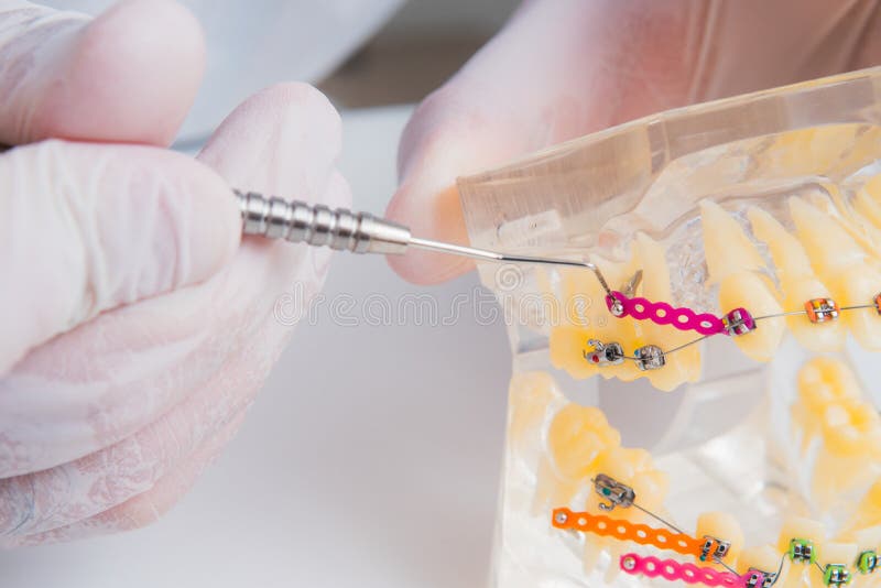 On Macro Photos Shows How the System of Brackets is Arranged Stock ...