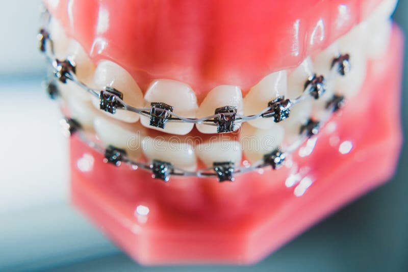 On Macro Photos Shows How the System of Brackets is Arranged Stock ...