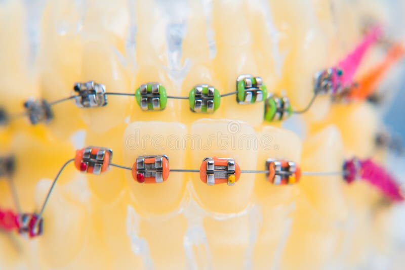 On Macro Photos Shows How the System of Brackets is Arranged Stock ...