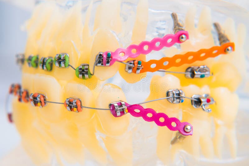 On Macro Photos Shows How the System of Brackets is Arranged Stock ...