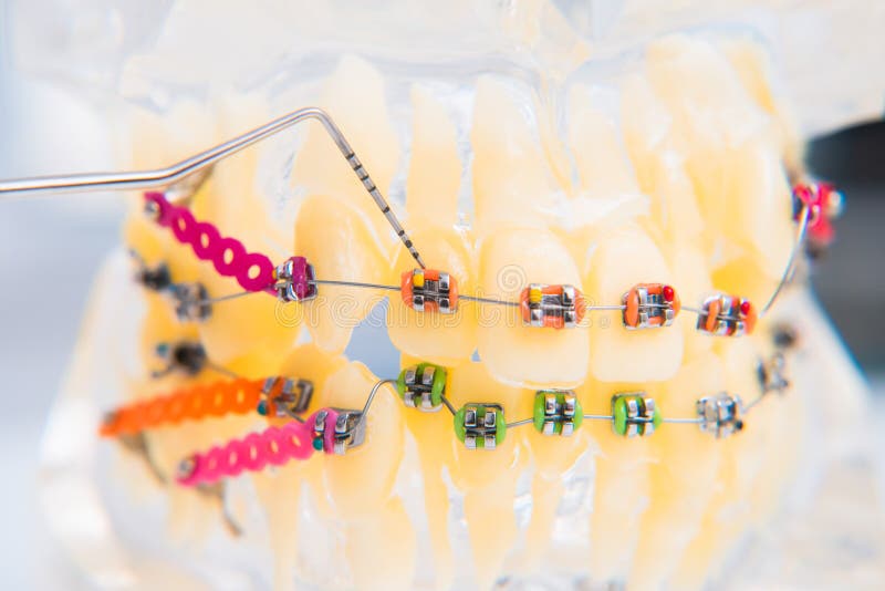 On Macro Photos Shows How the System of Brackets is Arranged Stock ...