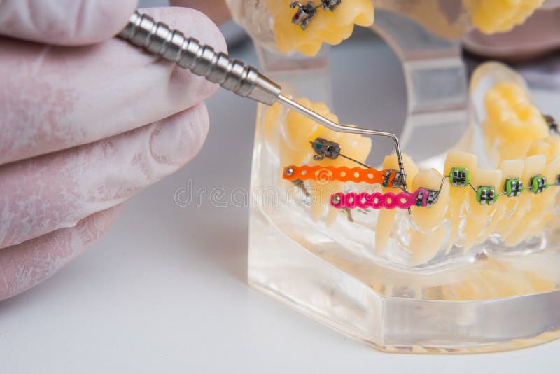 On Macro Photos Shows How the System of Brackets is Arranged Stock ...
