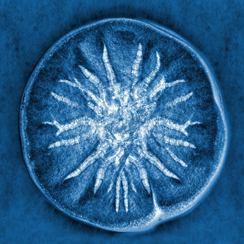 Macro X-ray Shot of Fuzzy Mold Stock Photo - Image of closeup ...