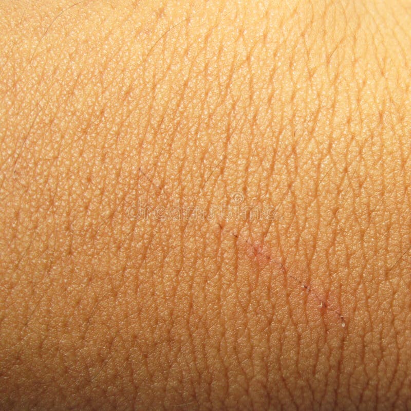 Scar on human skin stock photo. Image of rough, skin - 59257648