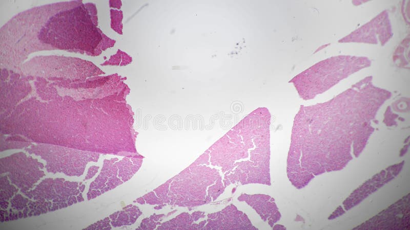 Human Pancreas Tissue in Section Filmed and Magnified Under Microscope ...