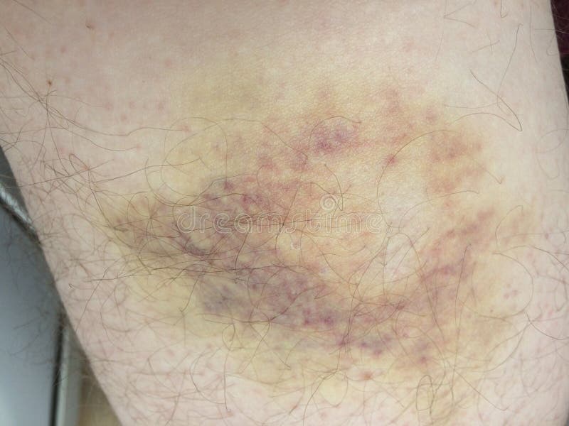 Skin stock photo. Image of dermatology, flat, healthy - 37521964