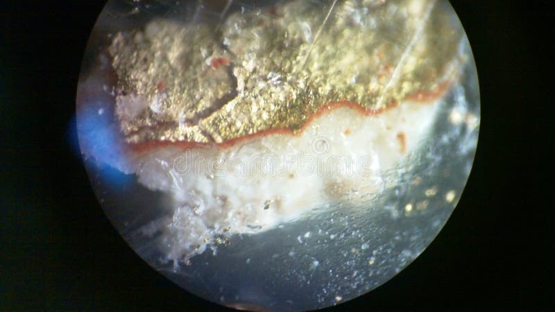 Gold Under Microscope Stock Photos - Free & Royalty-Free Stock Photos ...