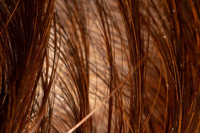 Macro hair on head skin stock image. Image of long, fashion - 180878513