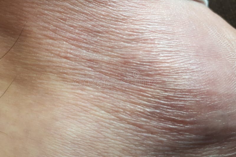 Shot of human skin leg stock photo. Image of dermatology - 144774320