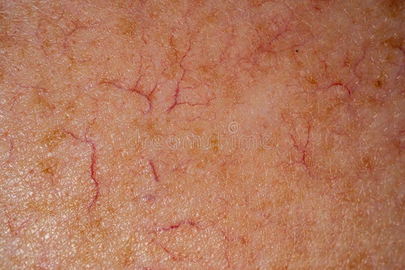 Macro Shot of the Human Skin with Veins. Stock Photo - Image of ...