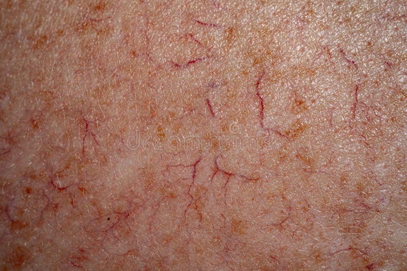 Macro Shot of the Human Skin with Veins. Stock Photo - Image of ...