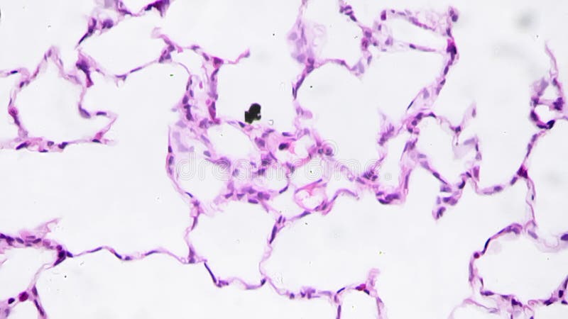 Lung of a Human in Longitudinal Section Filmed Under Microscope 400x ...