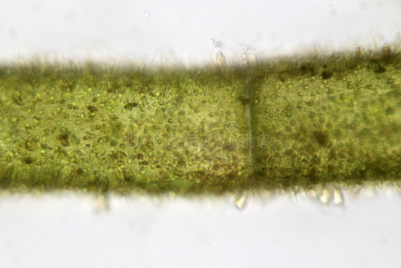 Reticulatum D'eau Douce De Hydrodictyon D'algues Supermacro Aquiculture ...