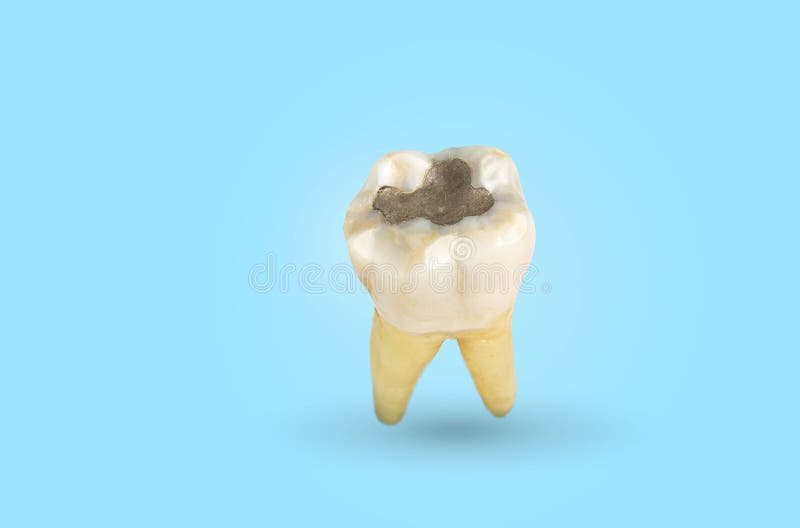 Mercury Teeth Stock Photos - Free & Royalty-Free Stock Photos from ...