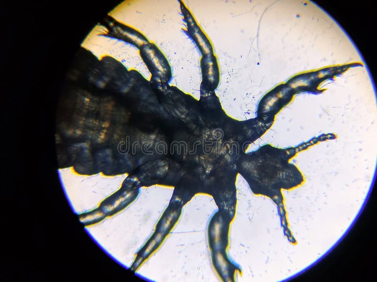 Macro view of head louse stock image. Image of single - 283013867