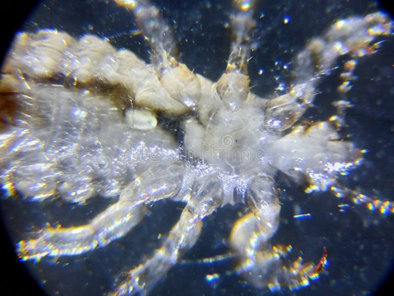 Macro view of head louse stock photo. Image of biological - 283013836