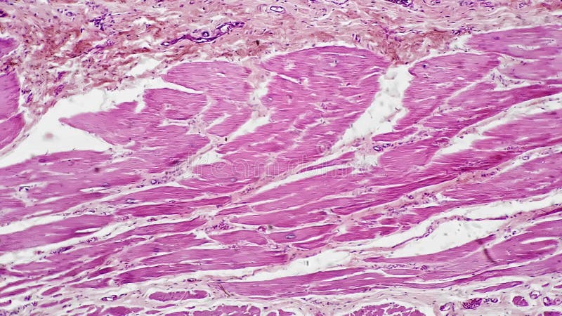 Human Stomach Anatomy Digestion, Esophagus Abdomen Gastric with Acid ...