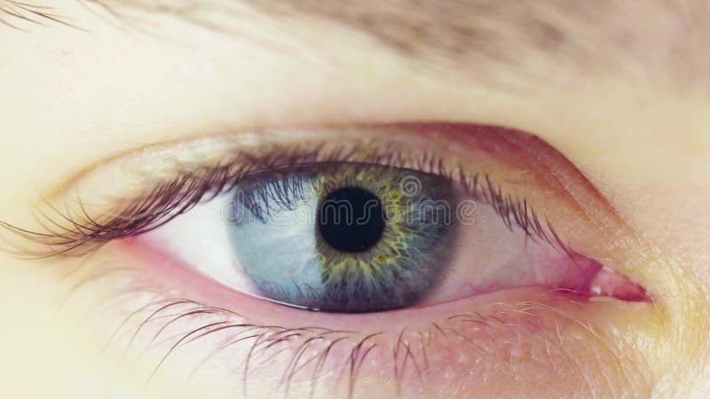 Blinking Human Eye. Constriction of the Iris in Bright Light Stock ...