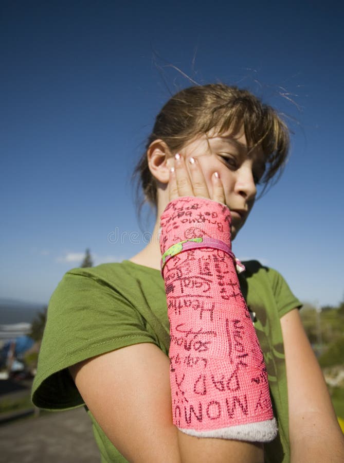 Child with Arm in Plaster Cast Stock Photo - Image of plaster ...