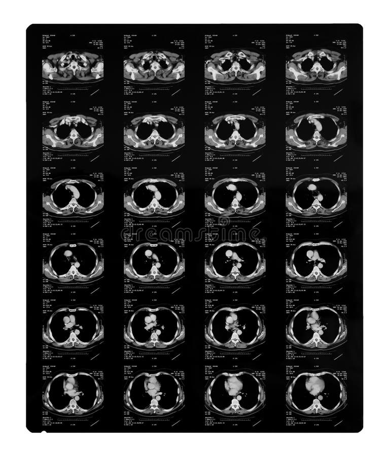 Magnetic resonance stock photo. Image of radiology, body - 13172132