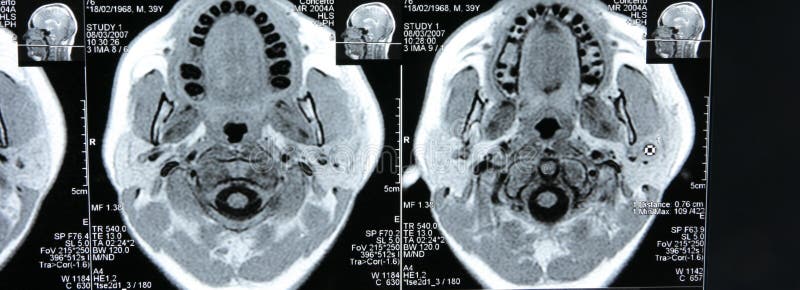 Magnetic resonance images stock image. Image of analysis - 25076955
