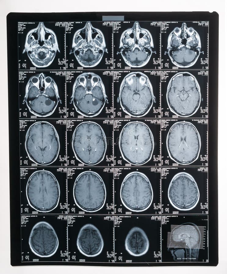 Magnetic Resonance Imaging, MRI, Computed Tomography, X-ray Image Stock ...