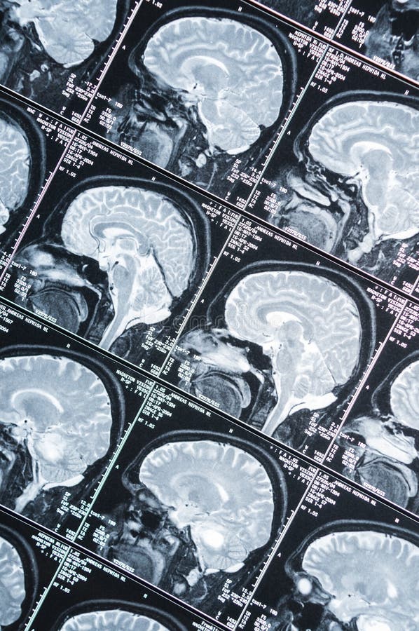 Magnetic Resonance Imaging, MRI, Computed Tomography, X-ray Image Stock ...