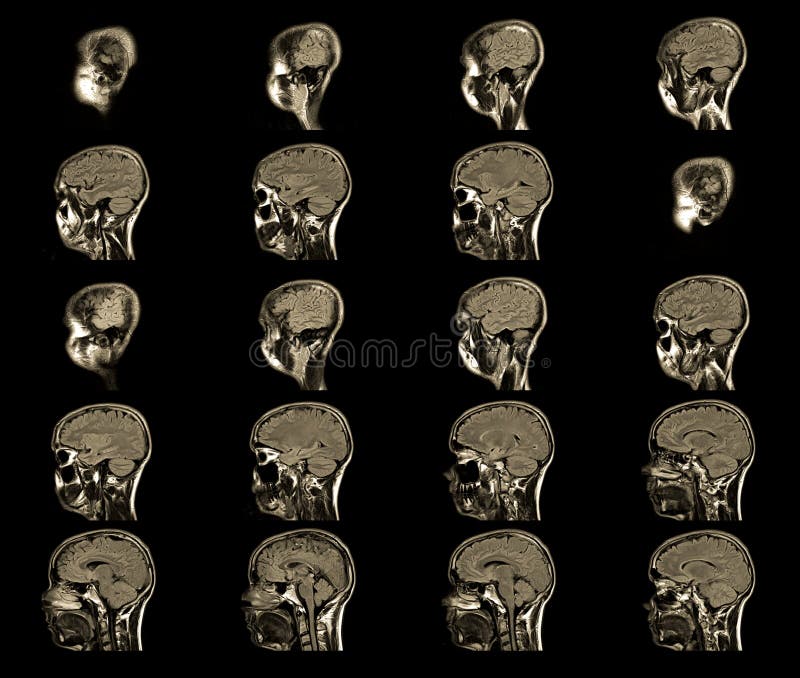 Magnetic Resonance Imaging, MRI MRT Head Stock Image - Image of healthy ...