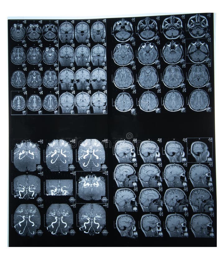 Magnetic Resonance Imaging (MRI) of the Spine Isolated on White Stock ... Magnetic Resonance Imaging (MRI) of the Spine Isolated on White Stock ...