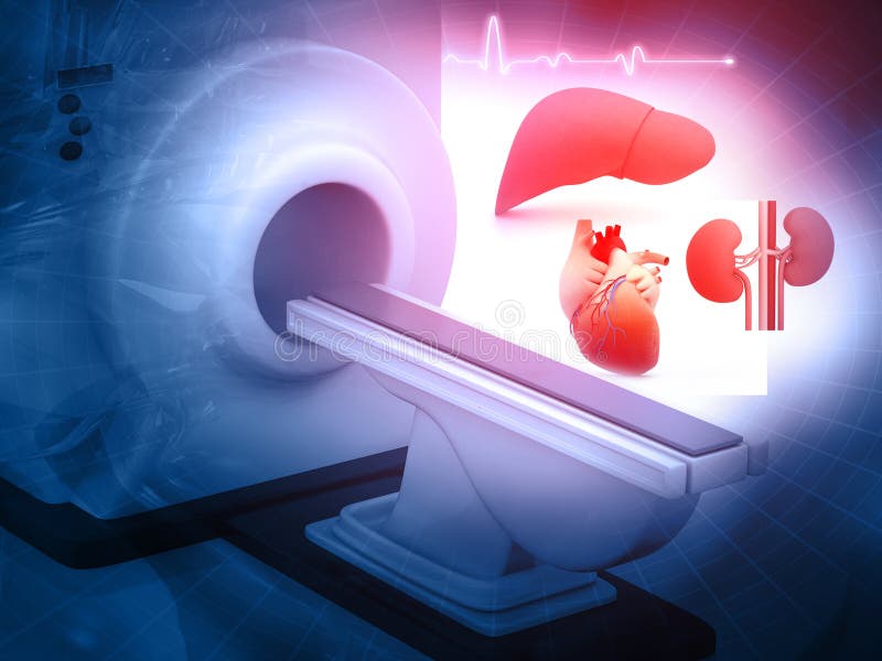 Magnetic Resonance Imagingsscanner, MRI, CT Scanners Stock Illustratie ...