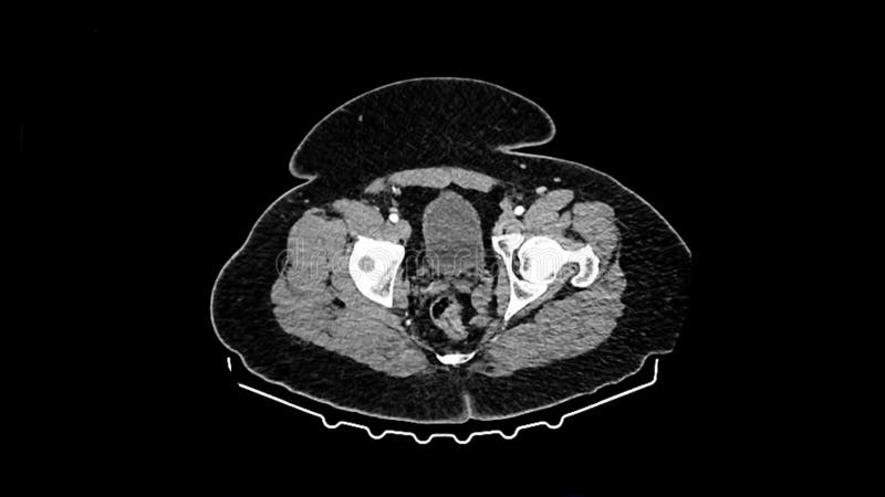 Magnetic Resonance Radiologist Visualization, MRI Scan on Screen ...