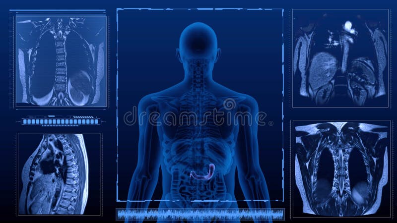 Magnetic Resonance Tomography Scan in Different Projections of the ...