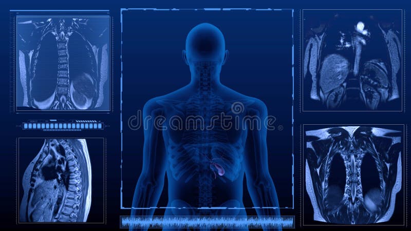 Magnetic Resonance Tomography Scan in Different Projections of the ...